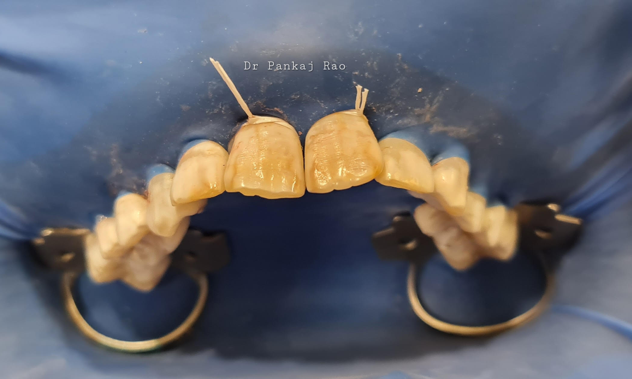 Gallery - Oraa Care Smile Dental Clinic