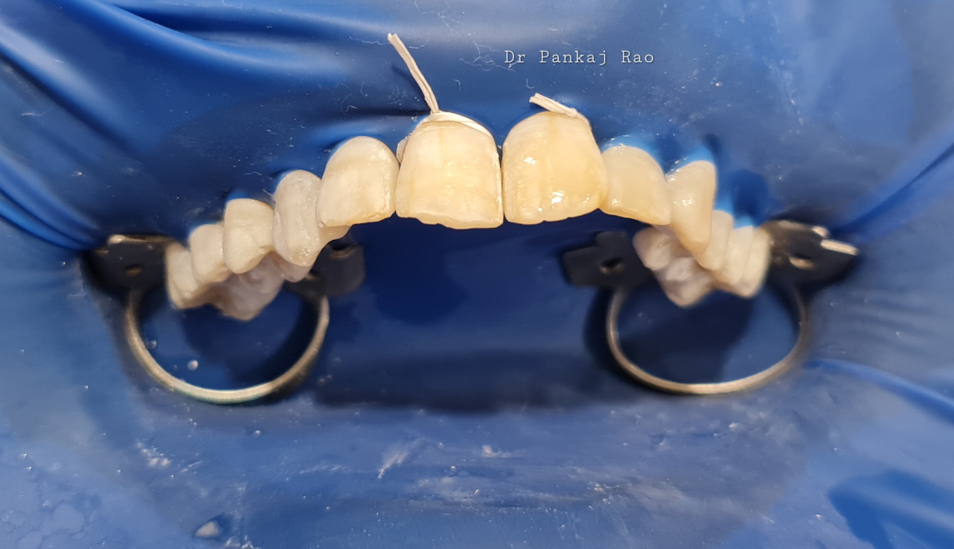 Gallery - Oraa Care Smile Dental Clinic